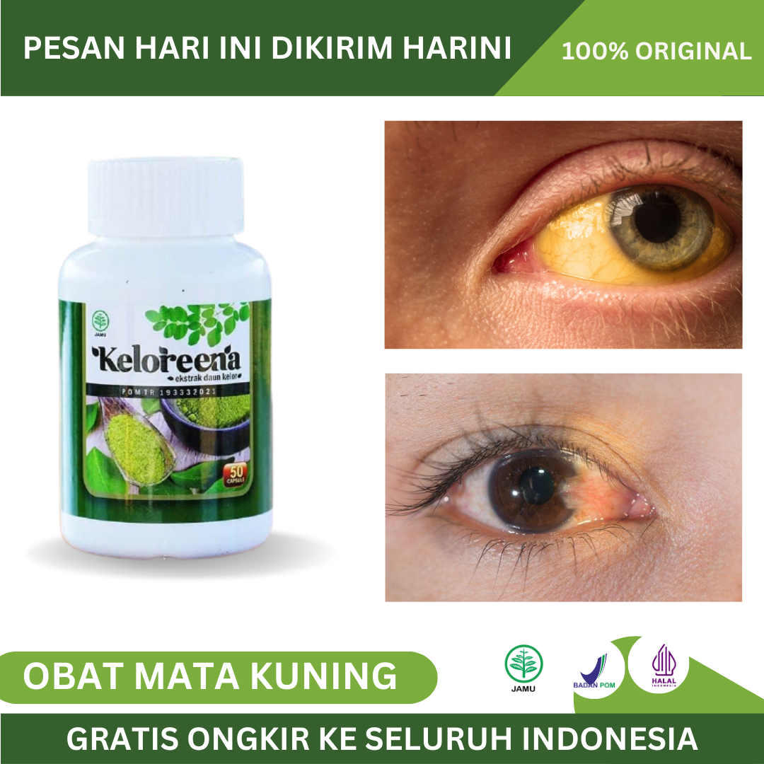 Obat Penjernih Mata , Pemutih Mata Kuning , Mata Berlemak , Penyakit ...