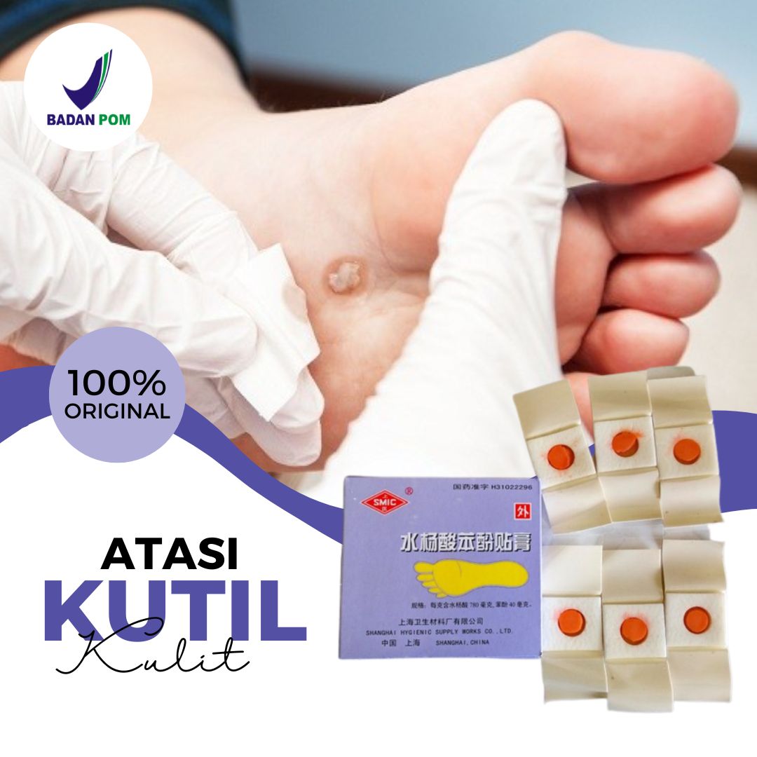Obat Kutil Paling Ampuh Di Jari Tangan Kaki Plester Penghilang ...