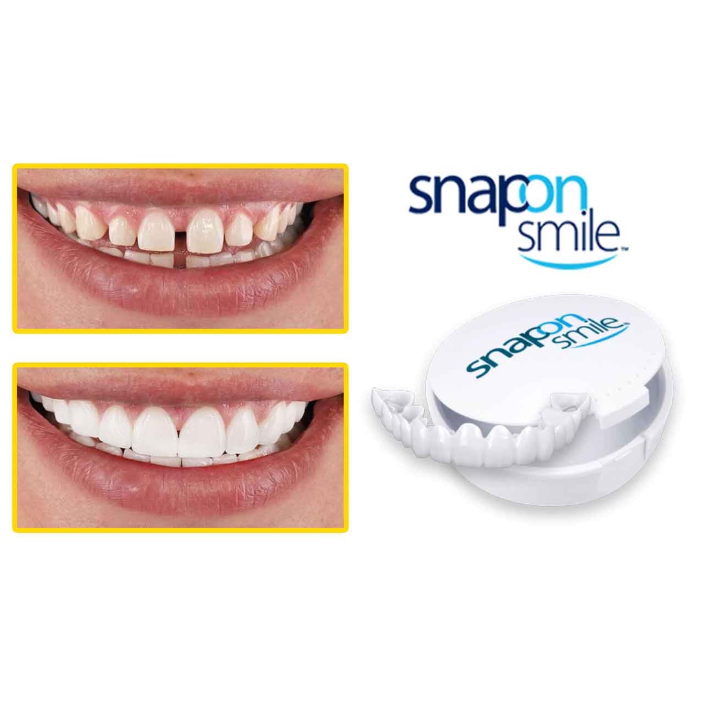 Snap On Smile Gigi Palsu Atas Bawah Pria Wanita Snap on Smile Veneers Gigi Perfect Smile Gigi ...