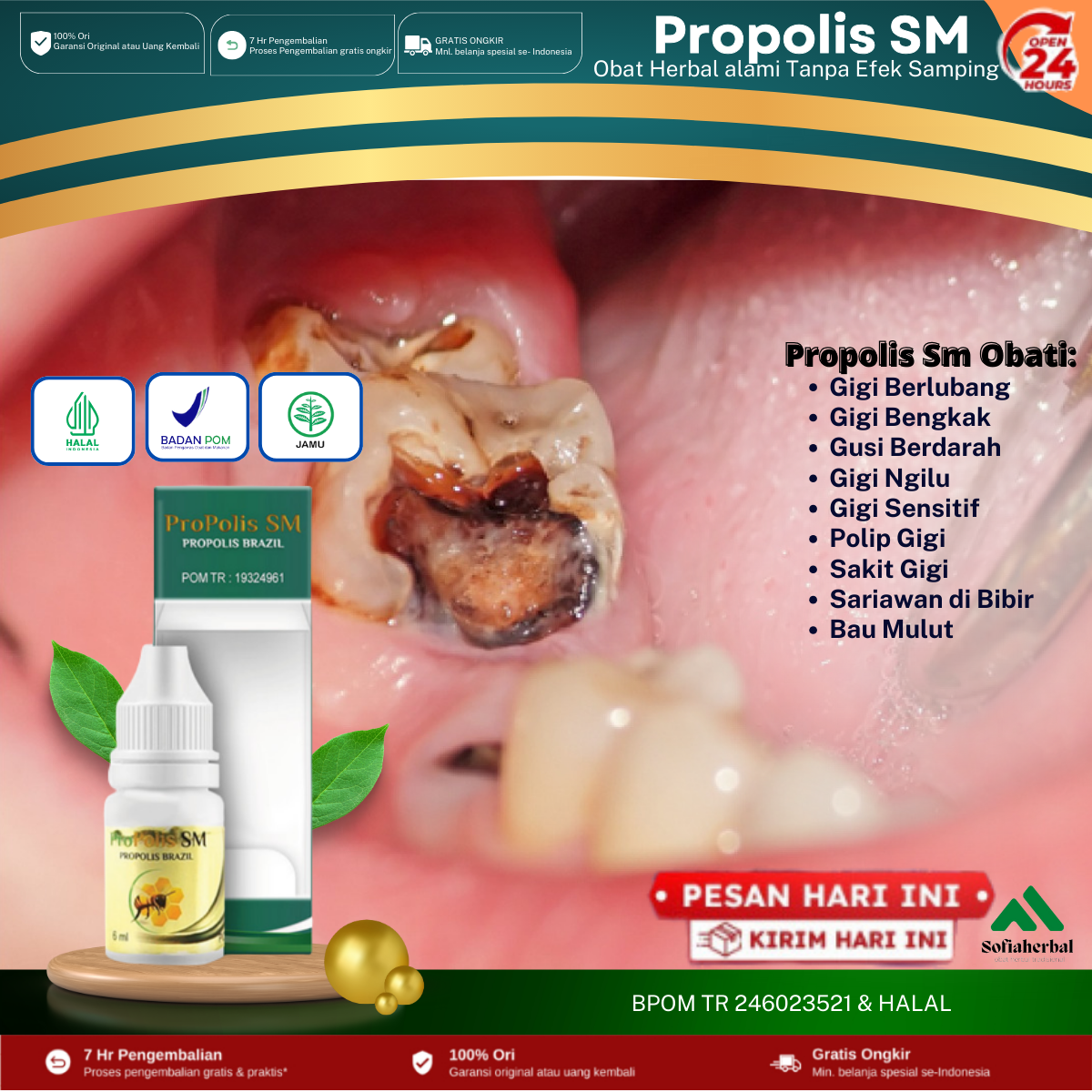 Obat sakit gigi berlubang Untuk Anak dan Dewasa, Gusi bengkak nyut nyutan, Sakit Gigi Kropok ...