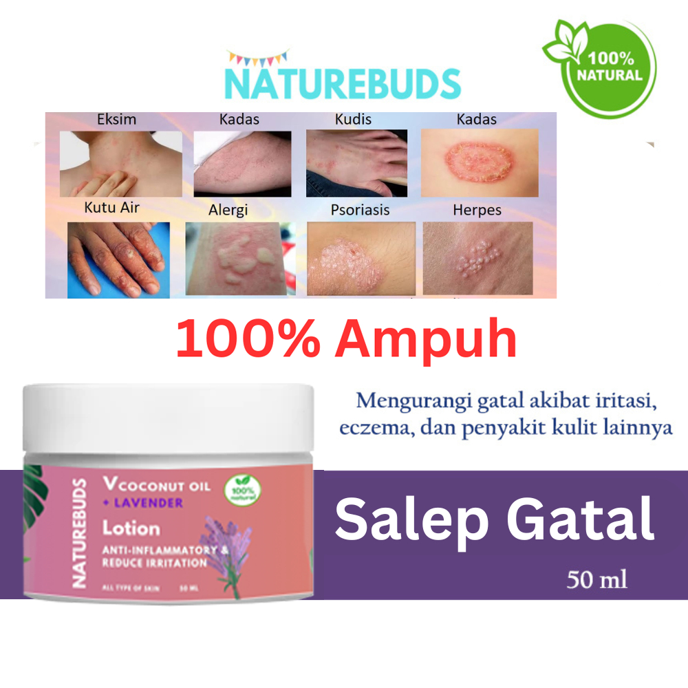 Salep Obat Gatal Paling Ampuh 100% Alergi Eksim Jamur Merah Gigitan ...