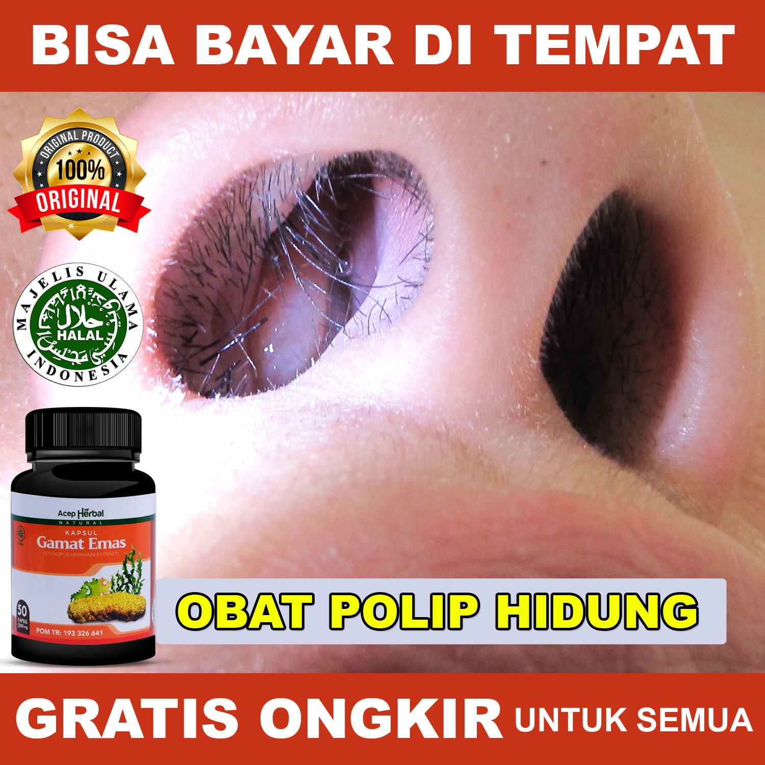 Obat Penghilang Polip Hidung Mengecilkan Merontokan Polip Hidung Aman No Bedah Benjolan Di ...