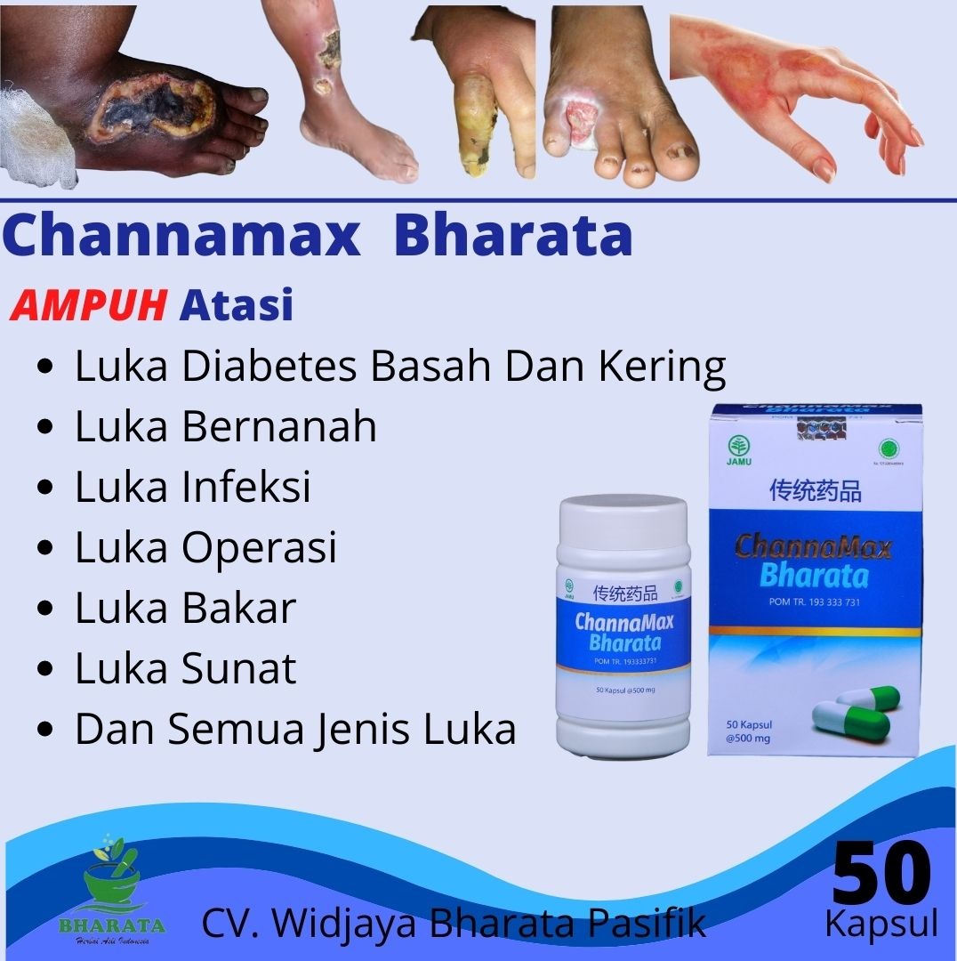 CHANNAMAX BHARATA ORIGINAL - Obat Luka Gula/Diabetes - Obat Luka ...
