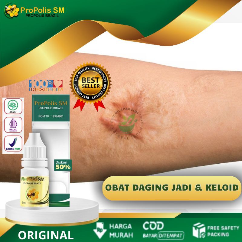 Obat Penghilang Keloid, Obat Keloid Menonjol Tahunan, Obat ...