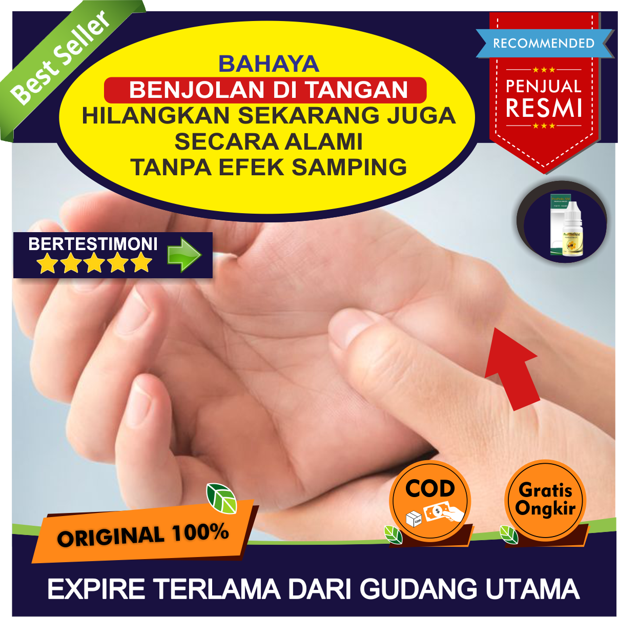 Obat Untuk Menghilangkan Benjolan Di Tangan, Obat Buat Benjolan Di ...