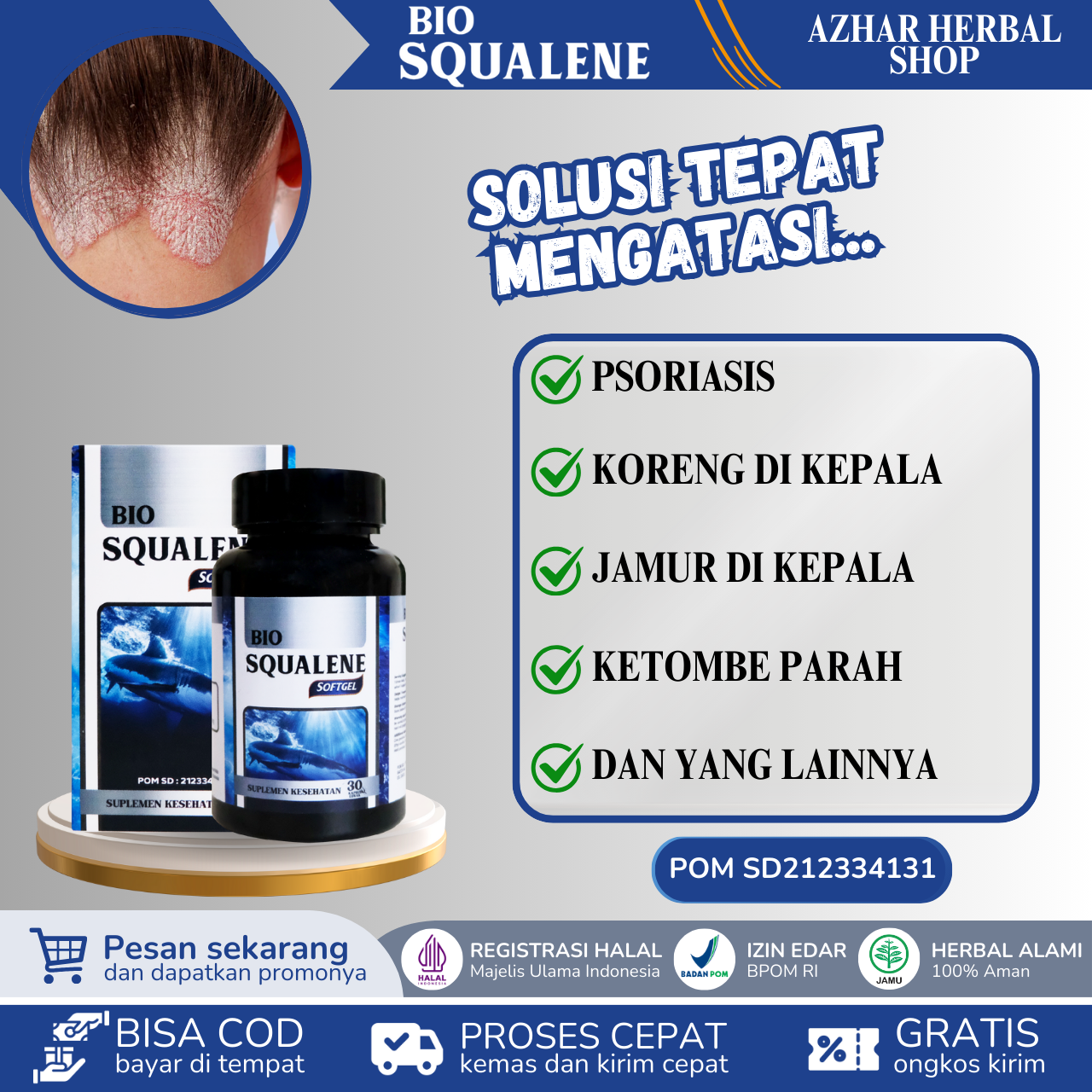 Bio Squalene Obat Kulit Kepala Psoriasis Korengan Berkerak Berjamur ...