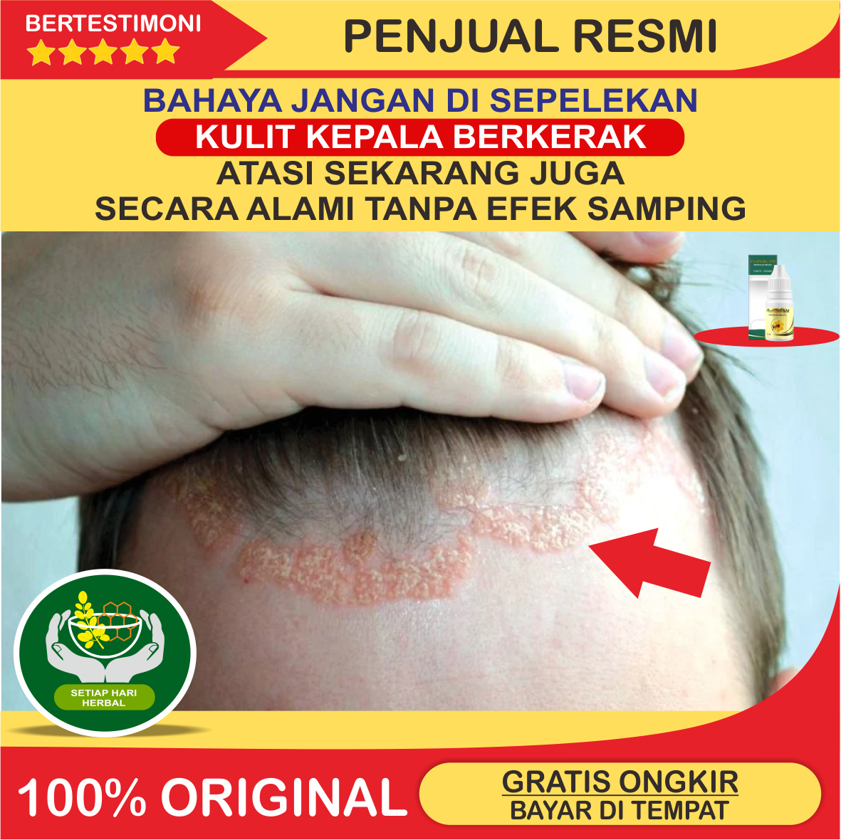 PROPOLIS SM Salep Kulit Kepala Berkerak Di Apotik, Salep Kulit Kepala ... PROPOLIS SM Salep Kulit Kepala Berkerak Di Apotik, Salep Kulit Kepala ...