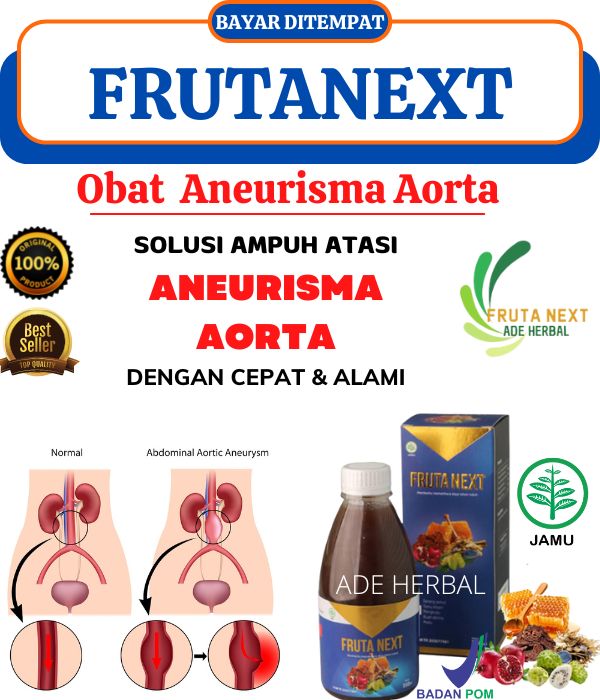 Obat Herbal Atasi Aneurisma Aorta/Mengatasi Nyeri Perut Terus Menerus ...