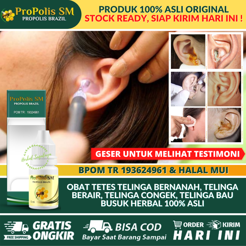 PROPOLIS SM - Obat Herbal Otomikosis - Obat Infeksi Jamur Pada Telinga ...