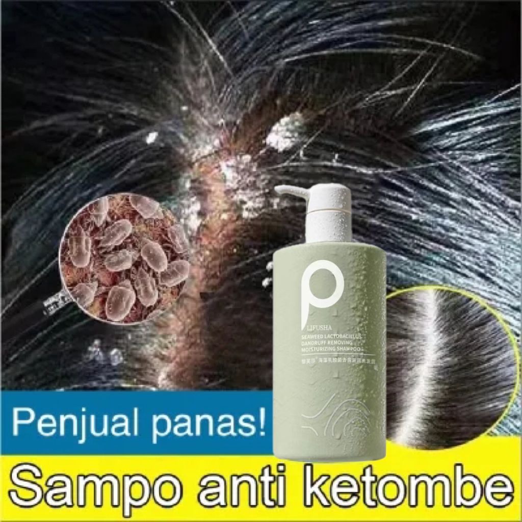 LIFUSHA Shampoo Anti Dandruff Removes Dandruff Contains sea salt to ...