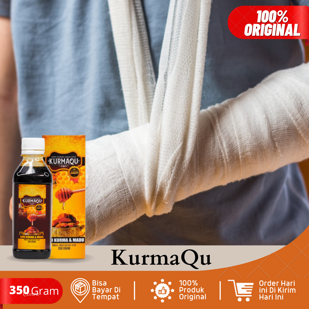 Obat Patah Tulang Untuk Anak & Dewasa, Tulang Retak, Tulang Remuk ...