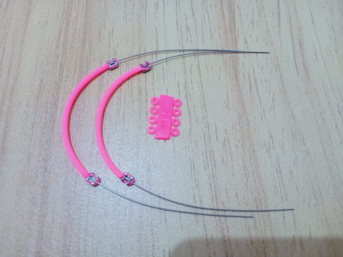 BEST SELLER!! TERLARIS Behel Thailand Bebas Pilih Warna Cocok Untuk ...