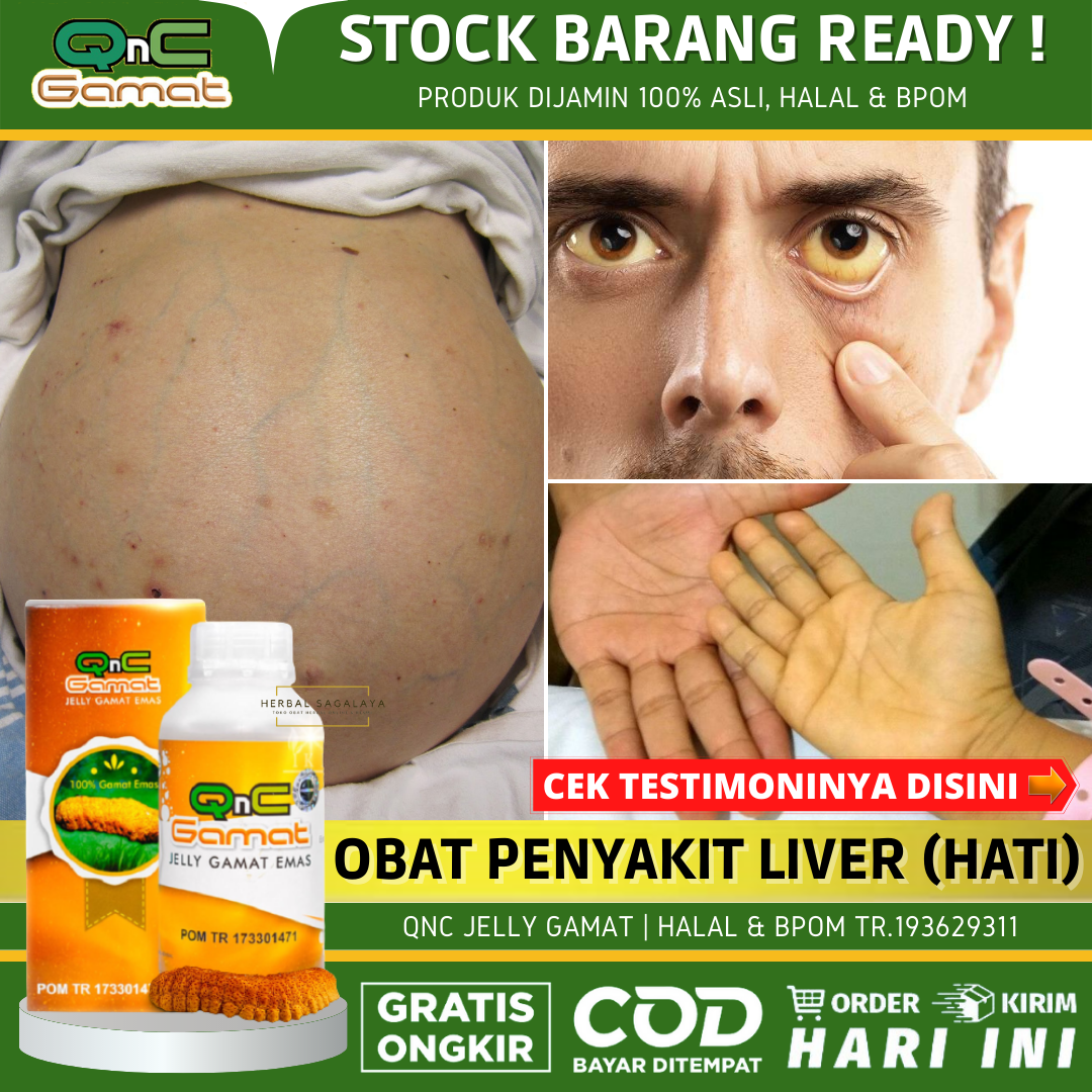 Jelly Gamat QNC Asli 100% - Obat Herbal Untuk Penyakit Kuning ...
