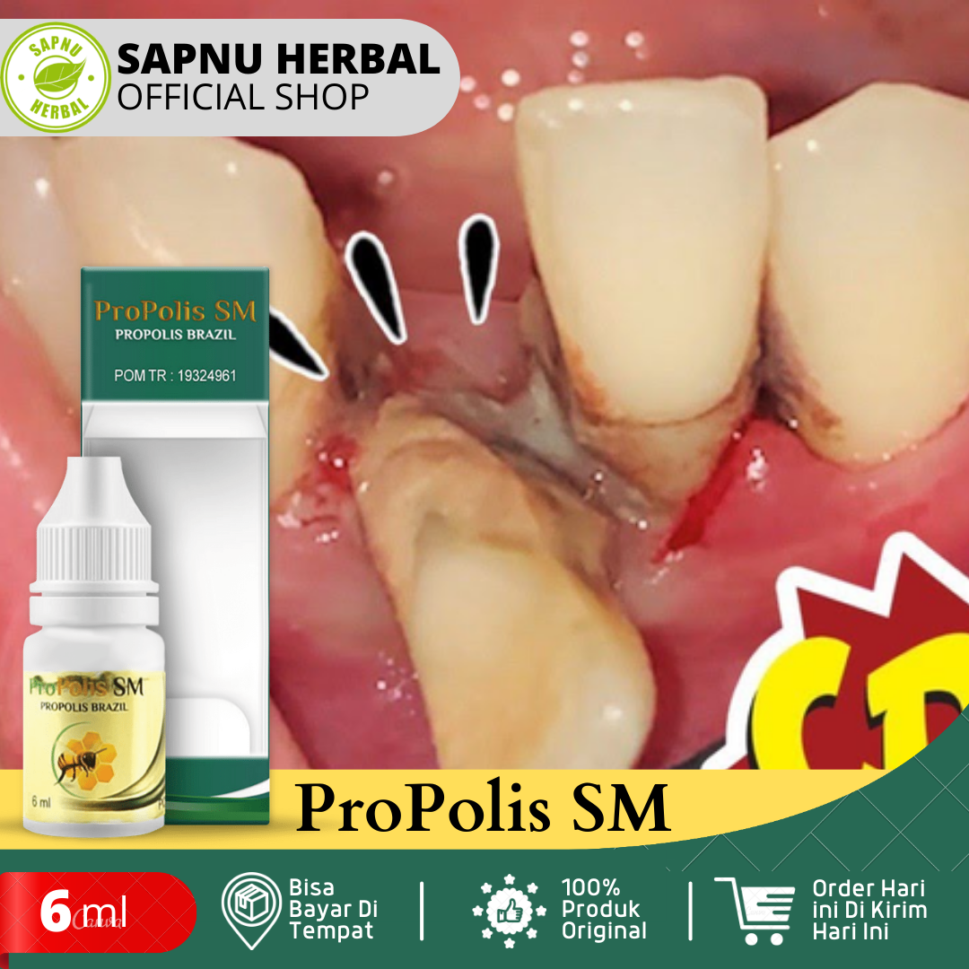 Obat Gigi Goyang, Sakit Gusi, Gigi Sensitif, Penguat Akar Gigi, Gusi Bengkak, Pereda Nyeri Gigi ...