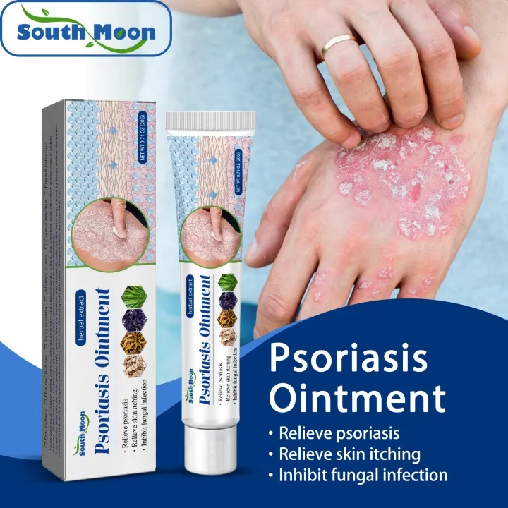 South Moon Psoriasis Ointment Psoriasis Eczema Cream Psoriasis ...