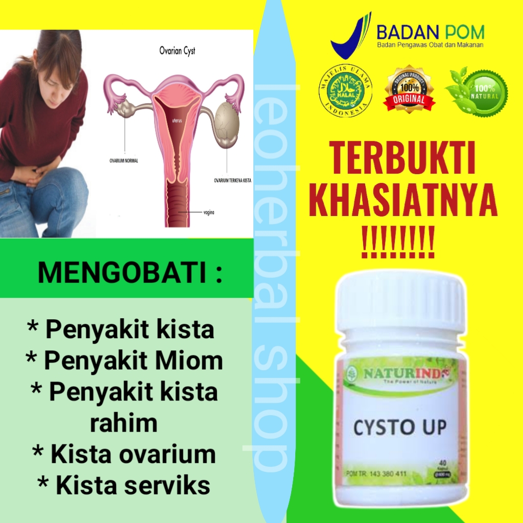 Obat Kista Obat Kista Ovarium Kista Rahim Kista Bartolin Kista Coklat ...