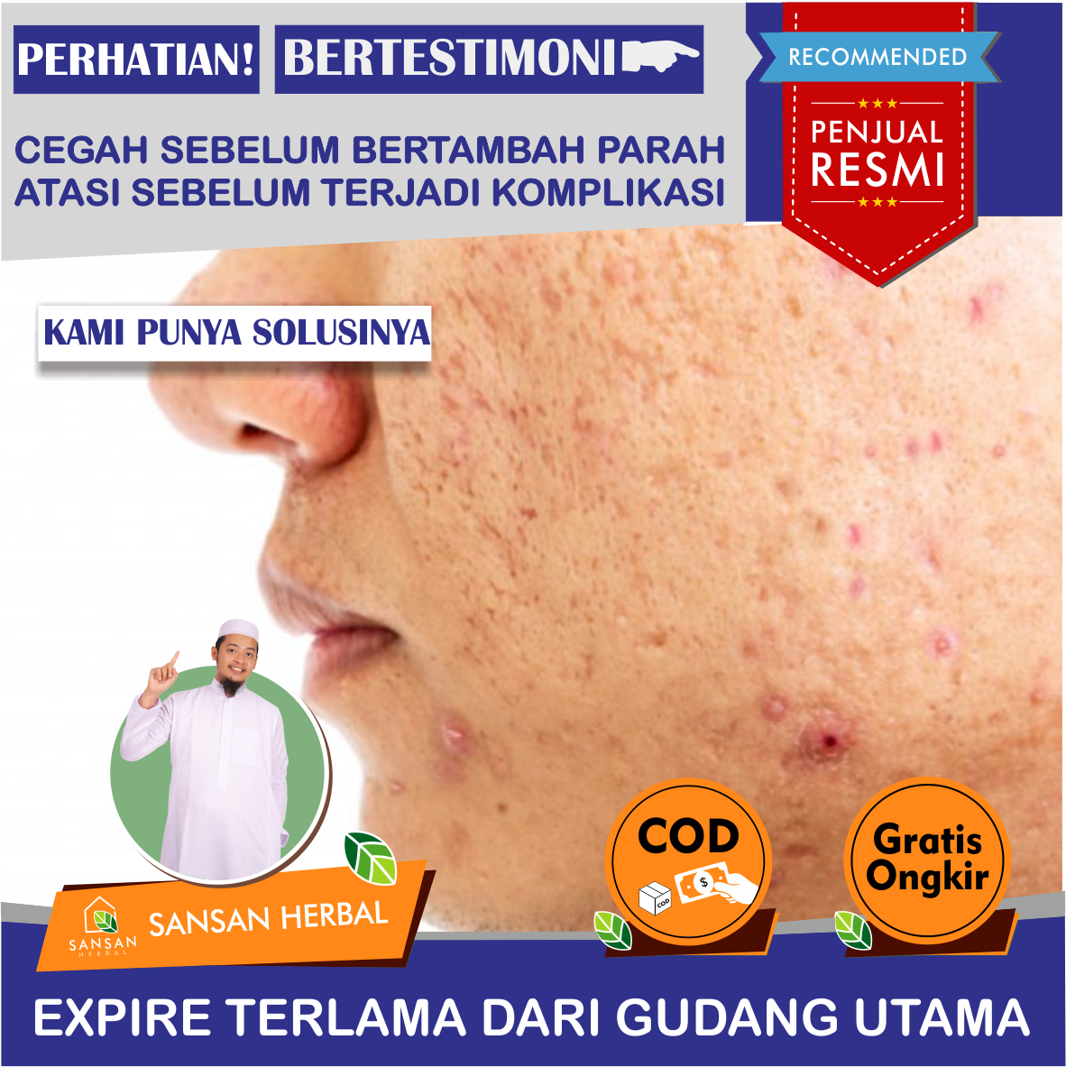 Obat Penghilang Bekas Cacar Di Muka, Obat Bekas Cacar Air Di Muka, Obat ... Obat Penghilang Bekas Cacar Di Muka, Obat Bekas Cacar Air Di Muka, Obat ...