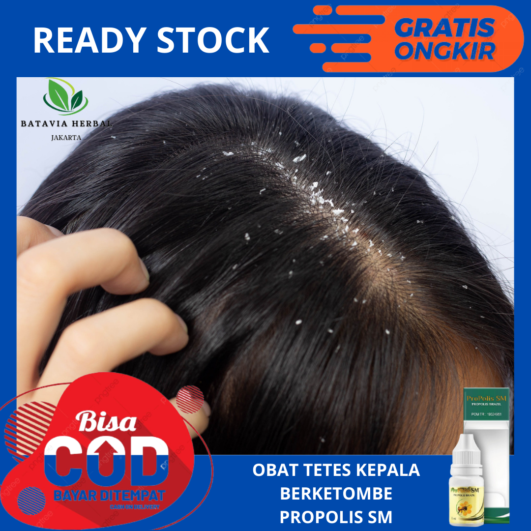 Obat Gatal Ketombe, Kulit Kepala Berkerak, Bersisik, Gatal Kulit Kepala, Ketombe Berkerak ...