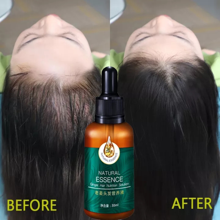 Hair Growth Spray PENUMBUH RAMBUT Cairan Serum Penumbuh Rambut Anti ...