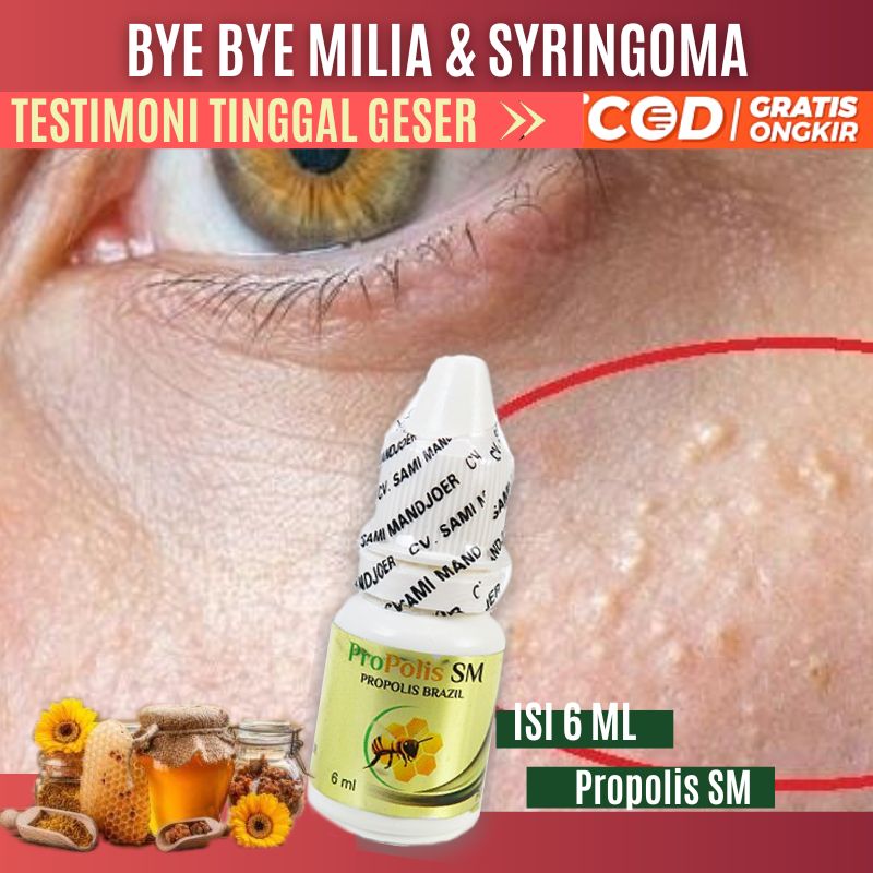 Obat Untuk Menghilangkan Bintik Bintik Kecil Di Wajah Yang Membandel ...