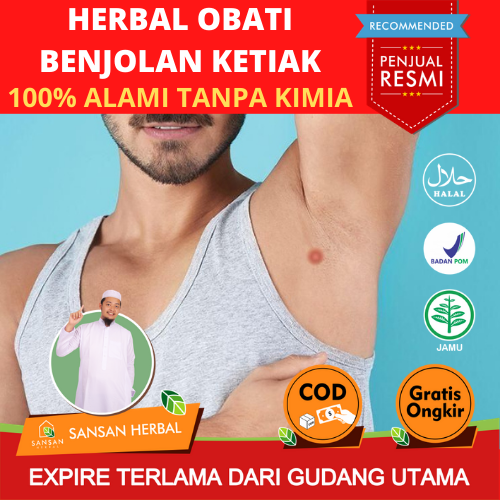 Obat Benjolan Ketiak Di Apotik, Obat Kelenjar Getah Bening Di Ketiak ...