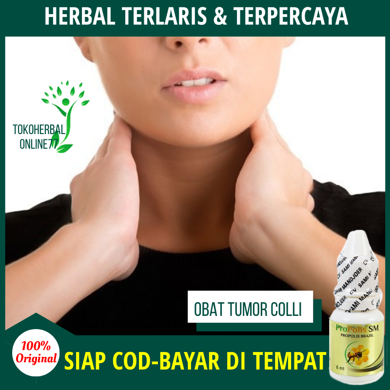 Obat Tumor Colli, Obat Benjolan di Leher, Obat Pembengkakan Kelenjar ...