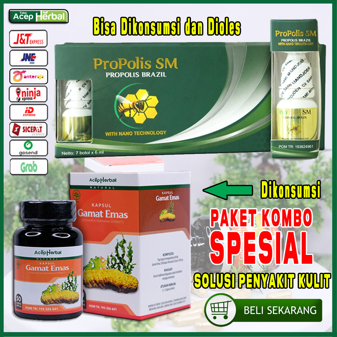 Obat autoimun Obat kudis Obat kurap Obat kusta Obat lupus Obat iritasi ...