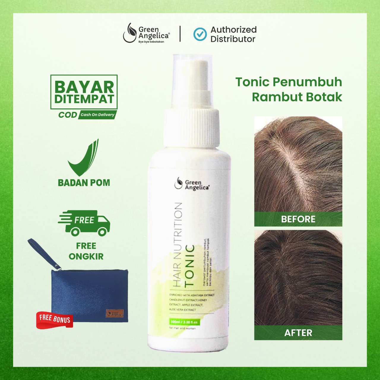 Green Angelica Hair Tonic Penumbuh Rambut Hasil Penumbuh Rambut Ketombe ...