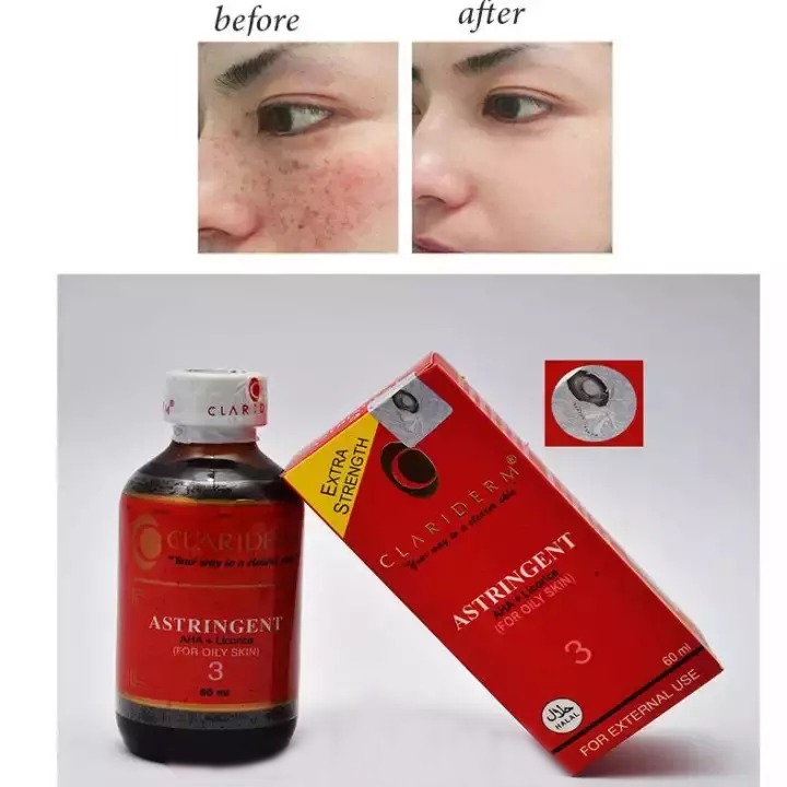 Toner Clariderm - Clariderm Astringent Alkohol No 3 / Toner Clariderm ...