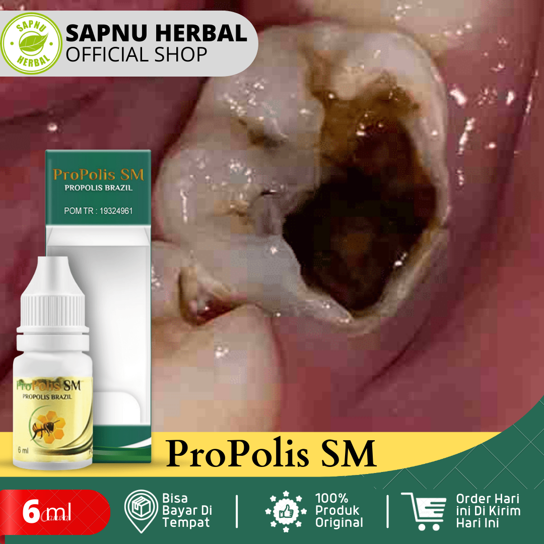 Obat Sakit Gigi Berlubang, Gusi Bengkak, Gigi Berlubang, Gigi Ngilu ...