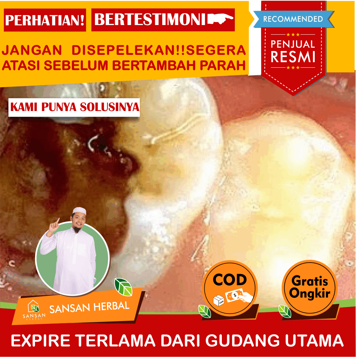 Obat Tetes Sakit Gigi Berlubang - Gusi Bengkak - Gigi Keropos - Gigi ...
