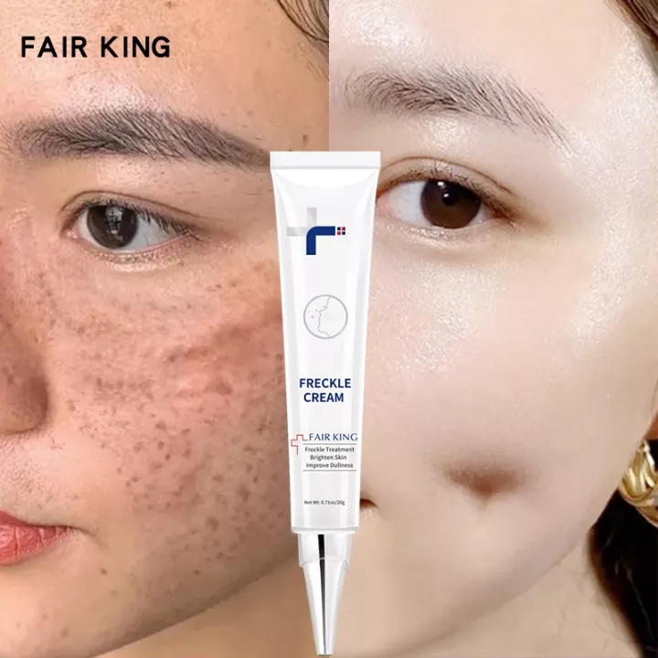 FAIR KING Effective Freckle Cream Remove Dark Spots Witening Cream Fade ...
