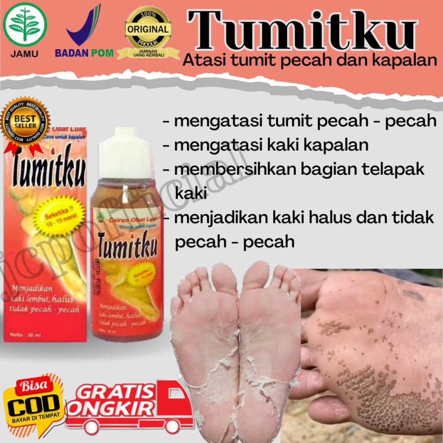 TUMITKU Obat Kaki Pecah Original BPOM Solusi Kaki Pecah-pecah Kapalan ...