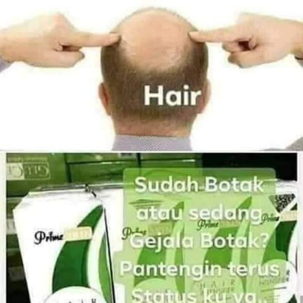 HAIR INTENSIFIER ,MEMBANTU MERAWAT RAMBUT RONTOK,KETOMBE ,BOTAK DAN ...