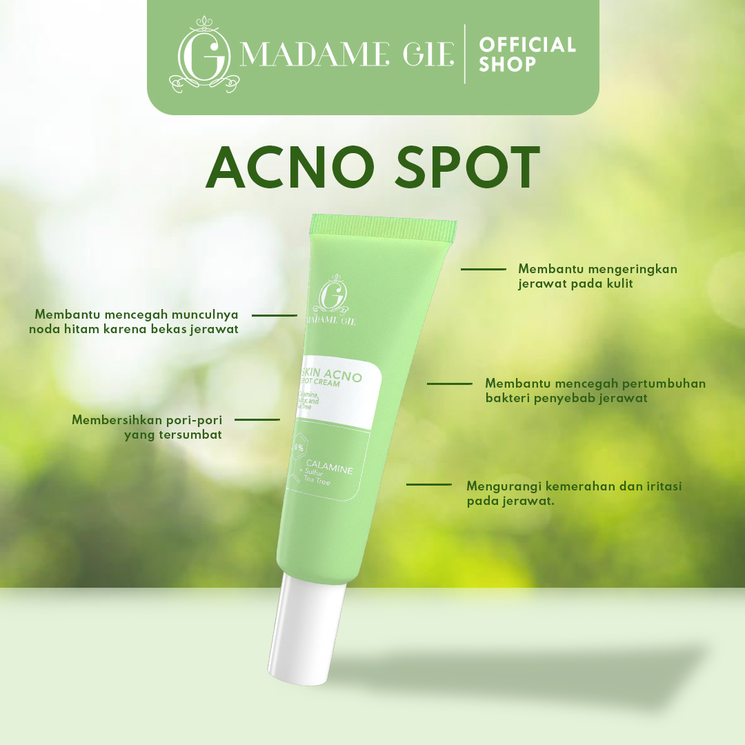 Madame Gie Madame Skin Acno Spot Cream - Acno Cream | Lazada Indonesia