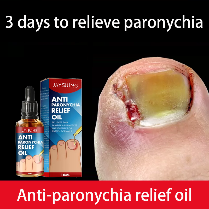 Removal Paronychia Oil Minyak bantuan anti-paronikia Nail Fungus ...
