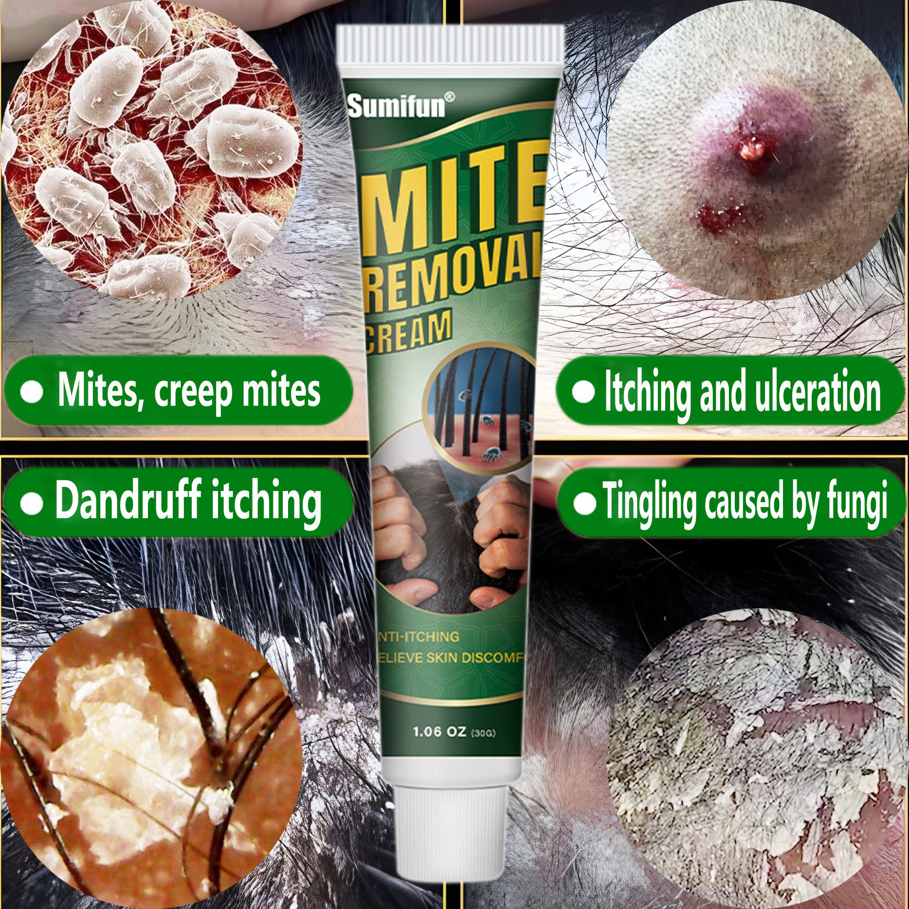 COD, Obat Koreng di kepala, obat salep gigitan tungau, obat gatal kulit ...