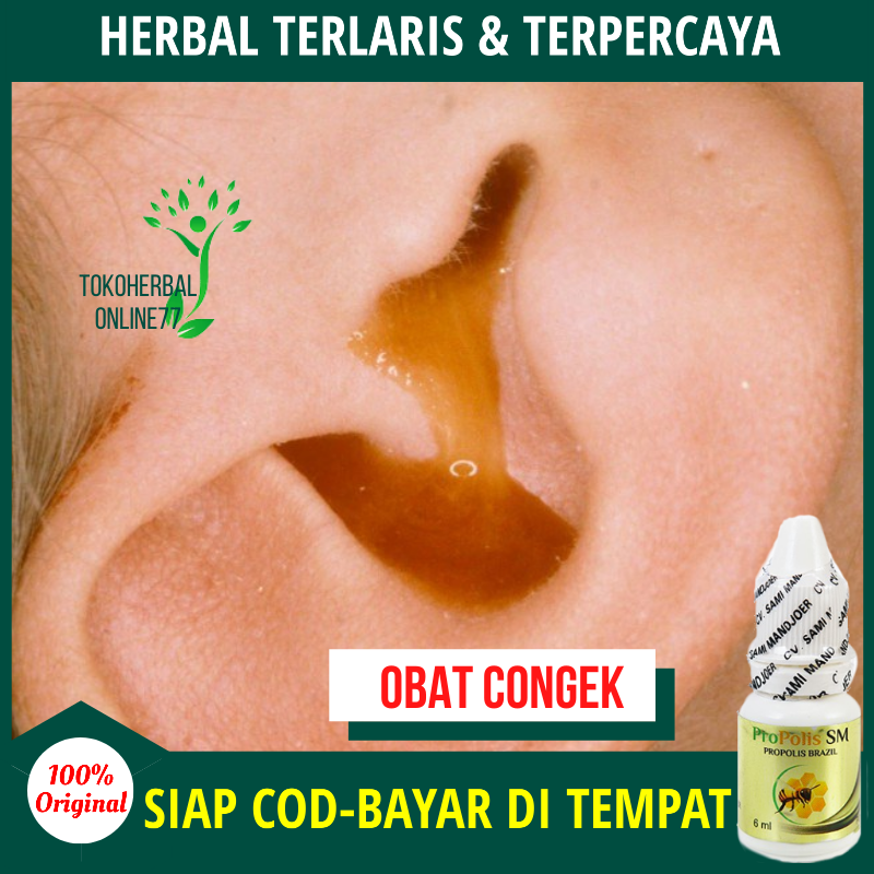 Obat Congek Anak dan Dewasa - Congek Menahun - Kuping Conge - Telinga ...
