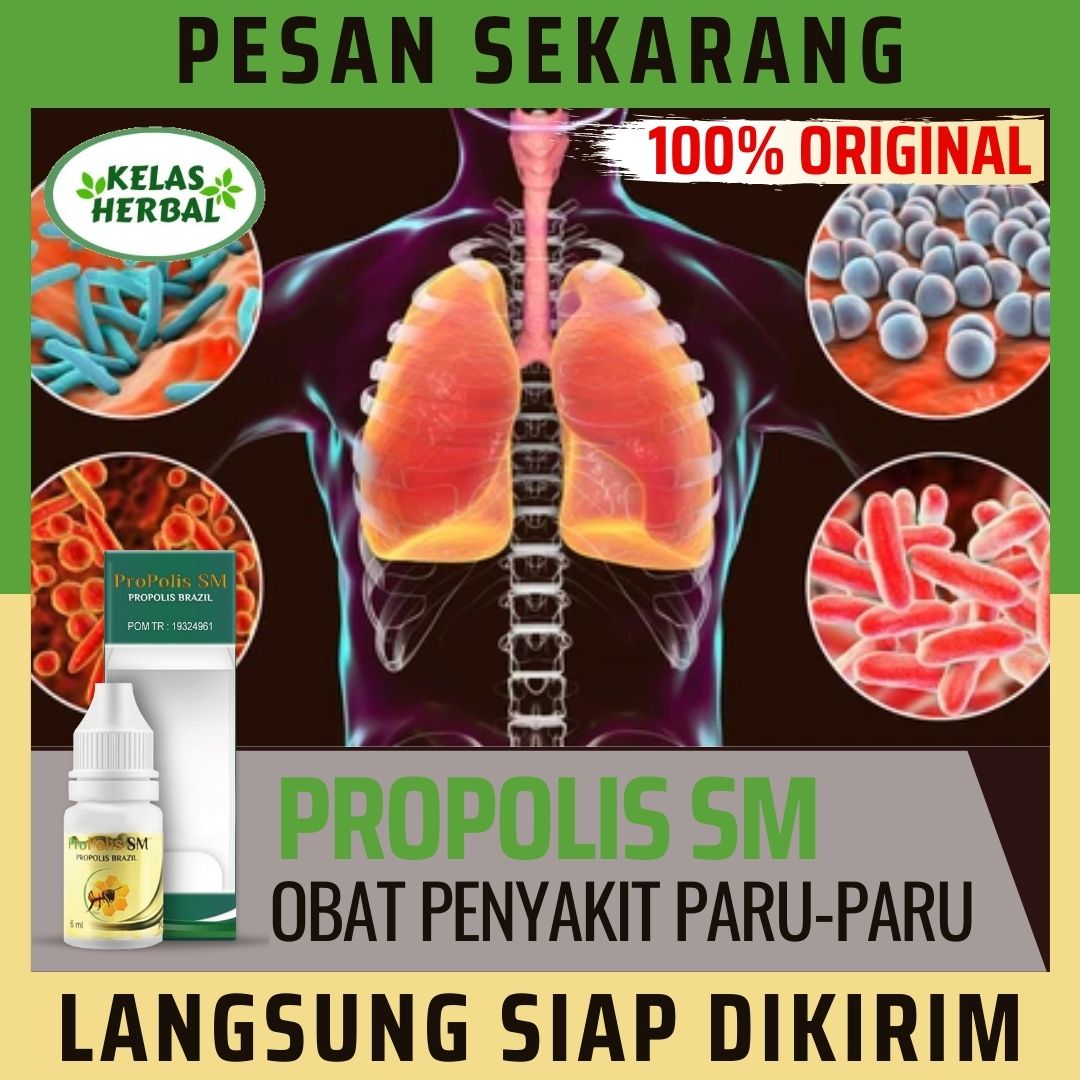 Propolis SM Brazil Solusi Obat untuk Paru Paru, Herbal Obat Paru Paru ...