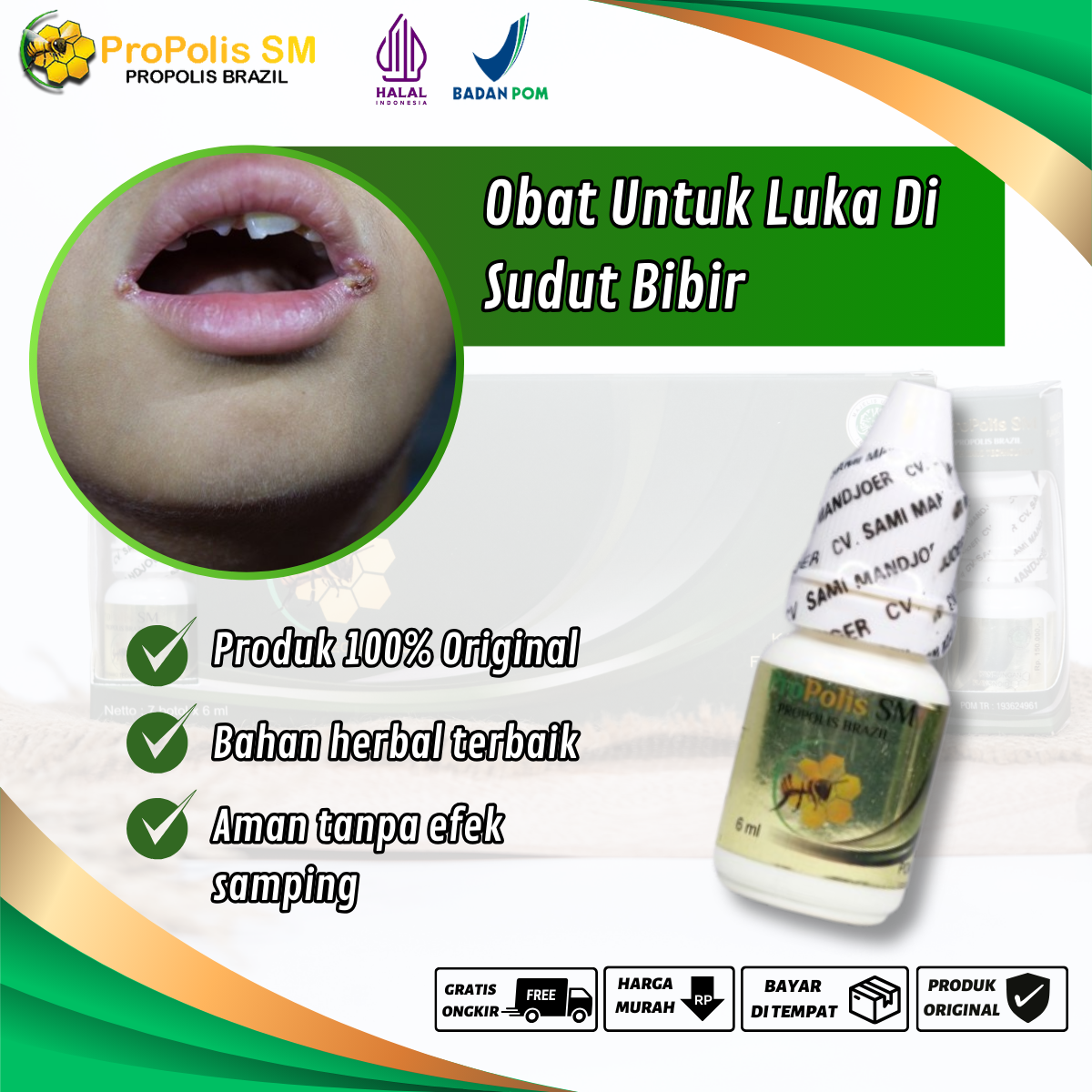 Obat Luka Di Sudut Bibir, Angular Cheilitis, Luka Ujung Bibir, Sudut ...