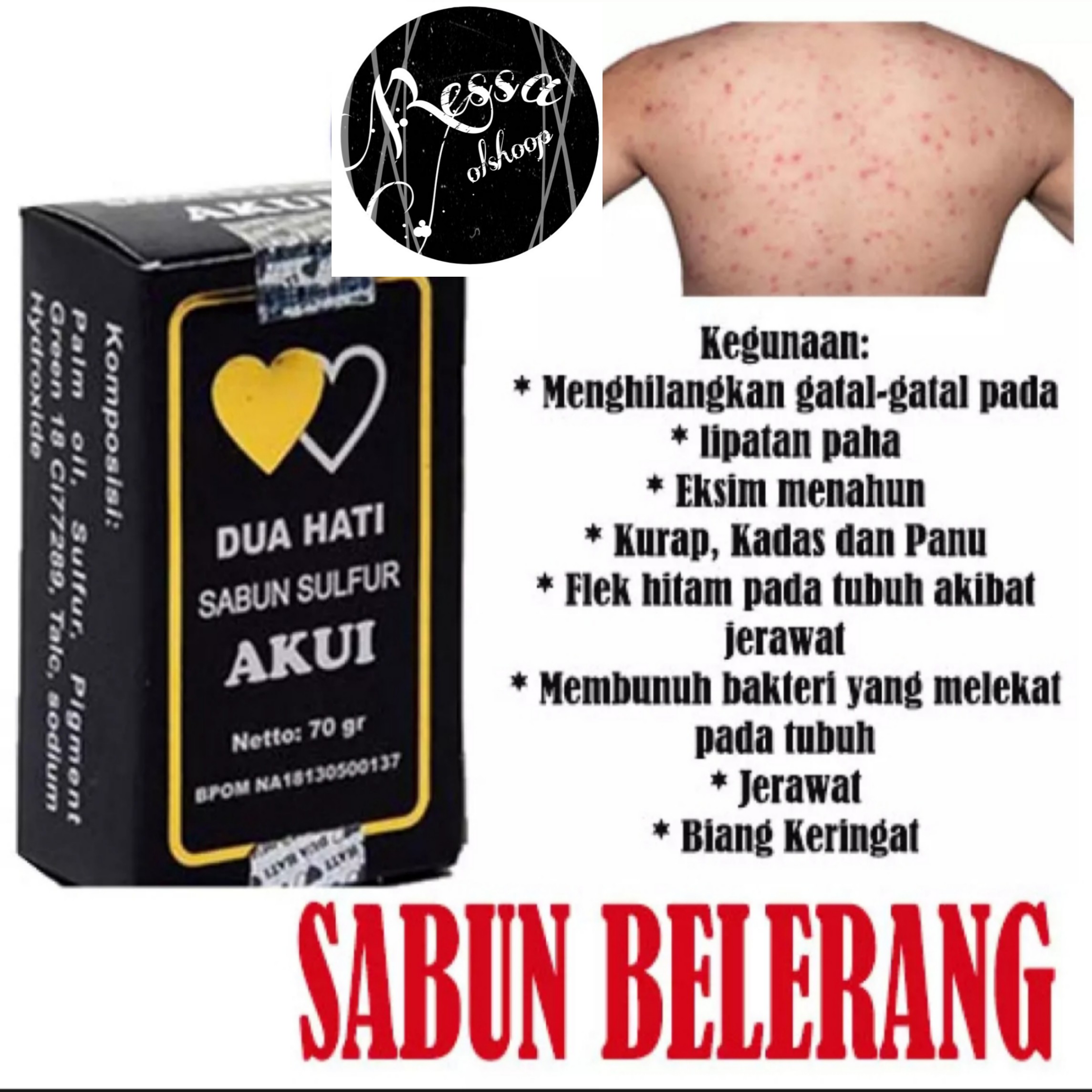 Sabun Gatal Kulit Sabun Akui Dua Hati Belerang Obat Penyakit Kulit Obat ...