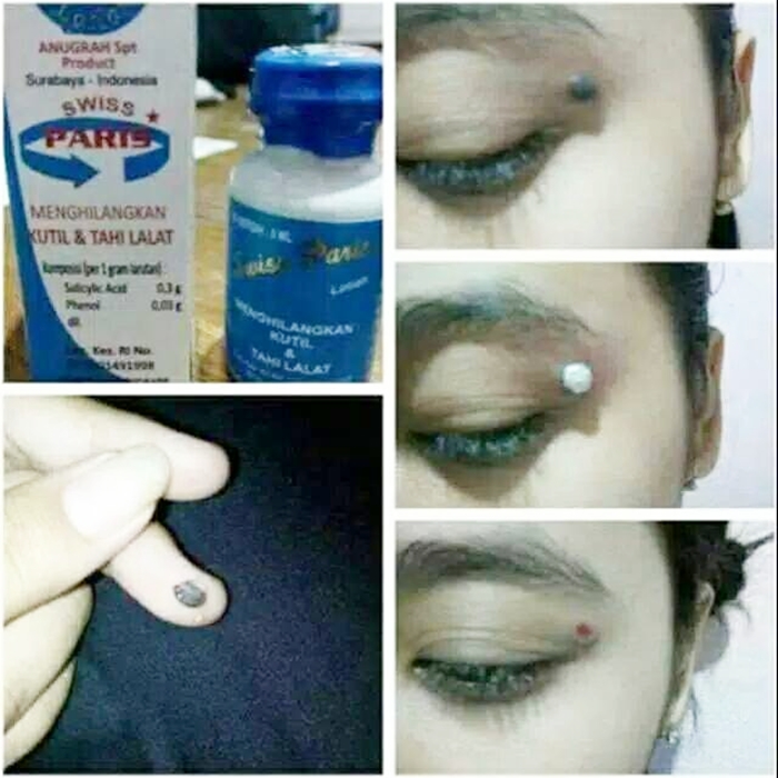 CREAM PENGHILANG KUTIL SWISS PARIS LOTION PELEPAS MENGANGKAT TAHILALAT ...