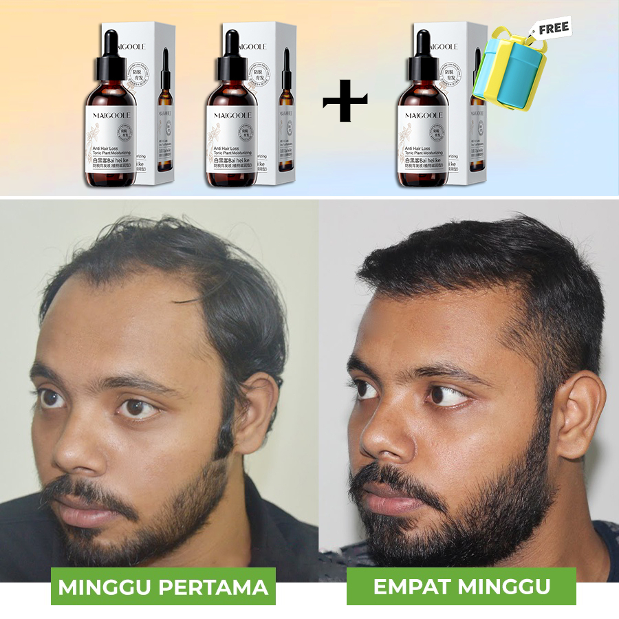 Esensi pertumbuhan rambut Rambut Rontok Perawatan Rambut Rambut Rontok ...