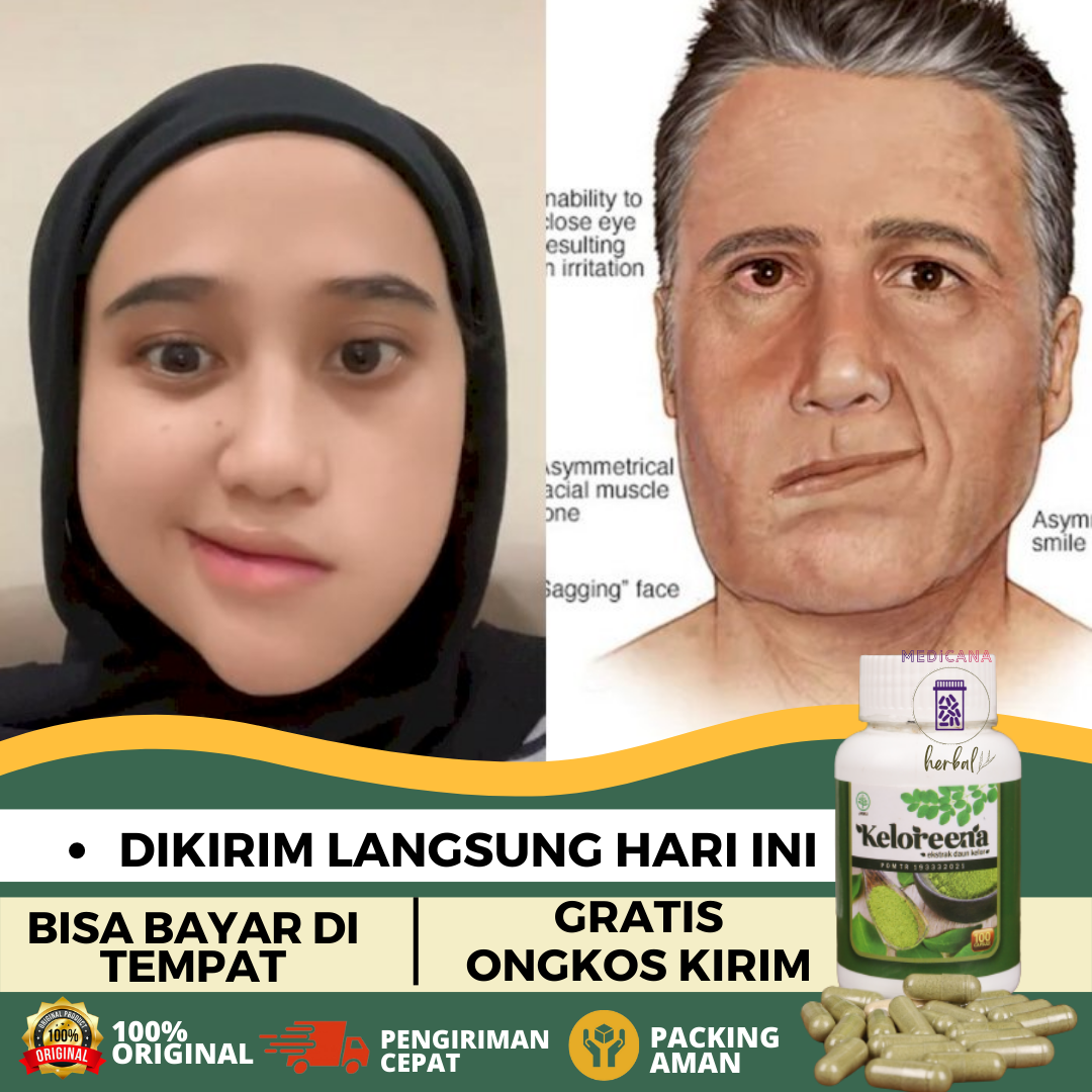 Obat Bells Palsy, Obat Herbal Bells Palsy, Obat Wajah Mencong Sebelah ...