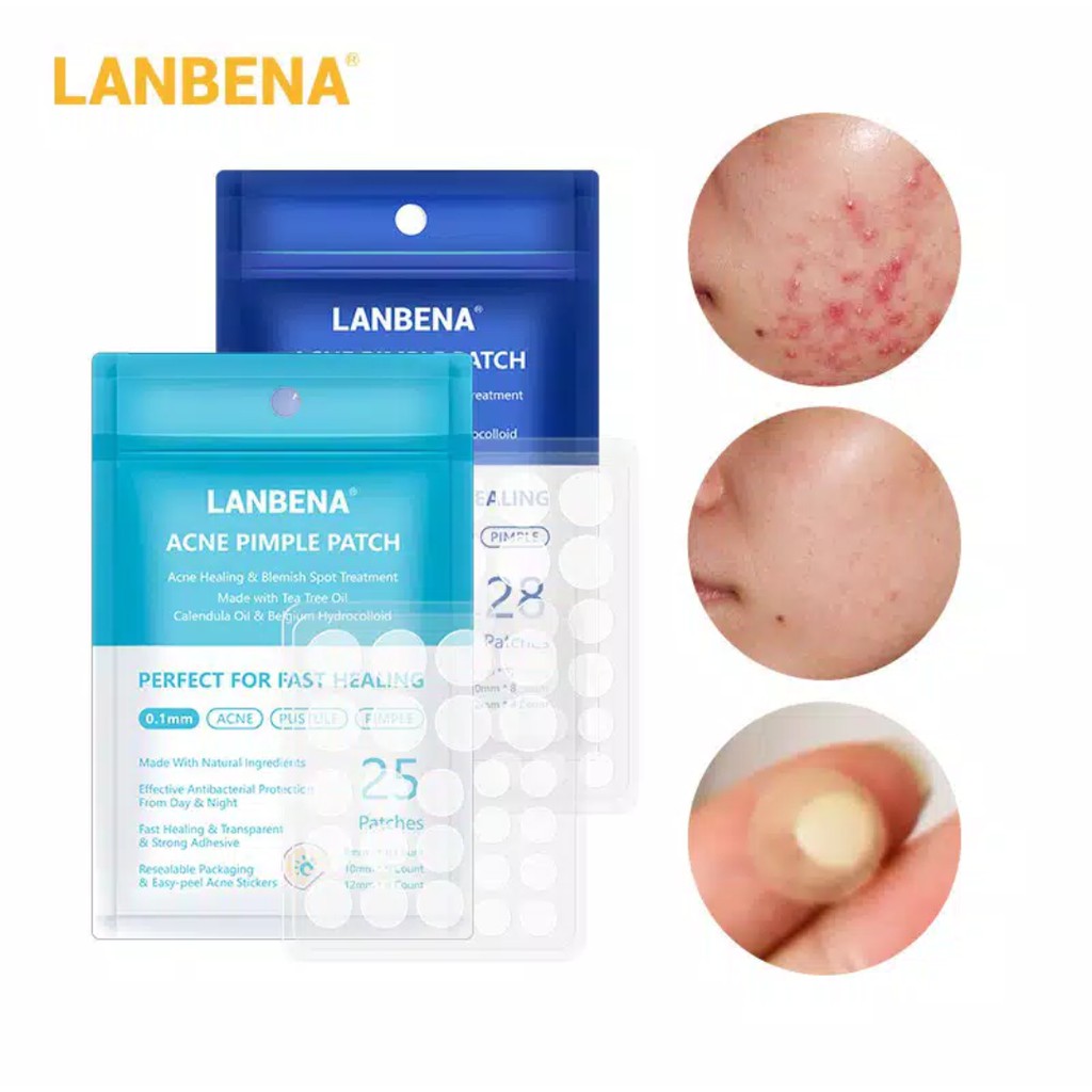 LANBENA Acne Pimple Patch Day (25 Stiker) + Night (28 Sticker) | Lazada ...