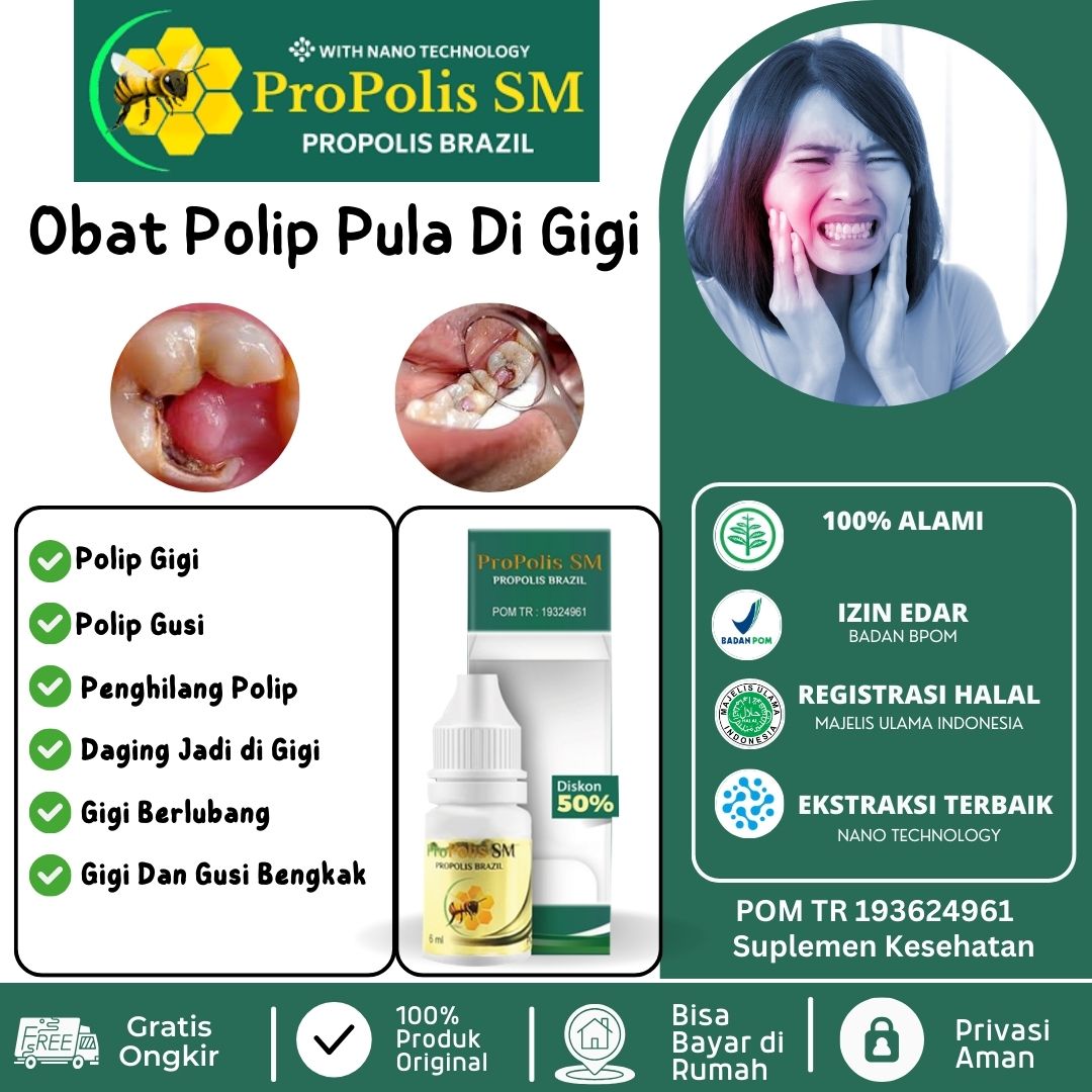 Obat Polip Pulpa Gigi, Obat Penghilang Polip Gigi, Obat Polip Gigi ...
