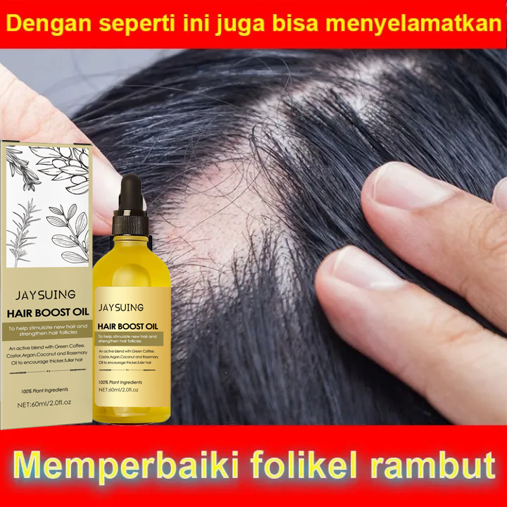 60ML PENUMBUH RAMBUT Oil Minyak Penumbuh Hair Growth Spray Penumbuh ...