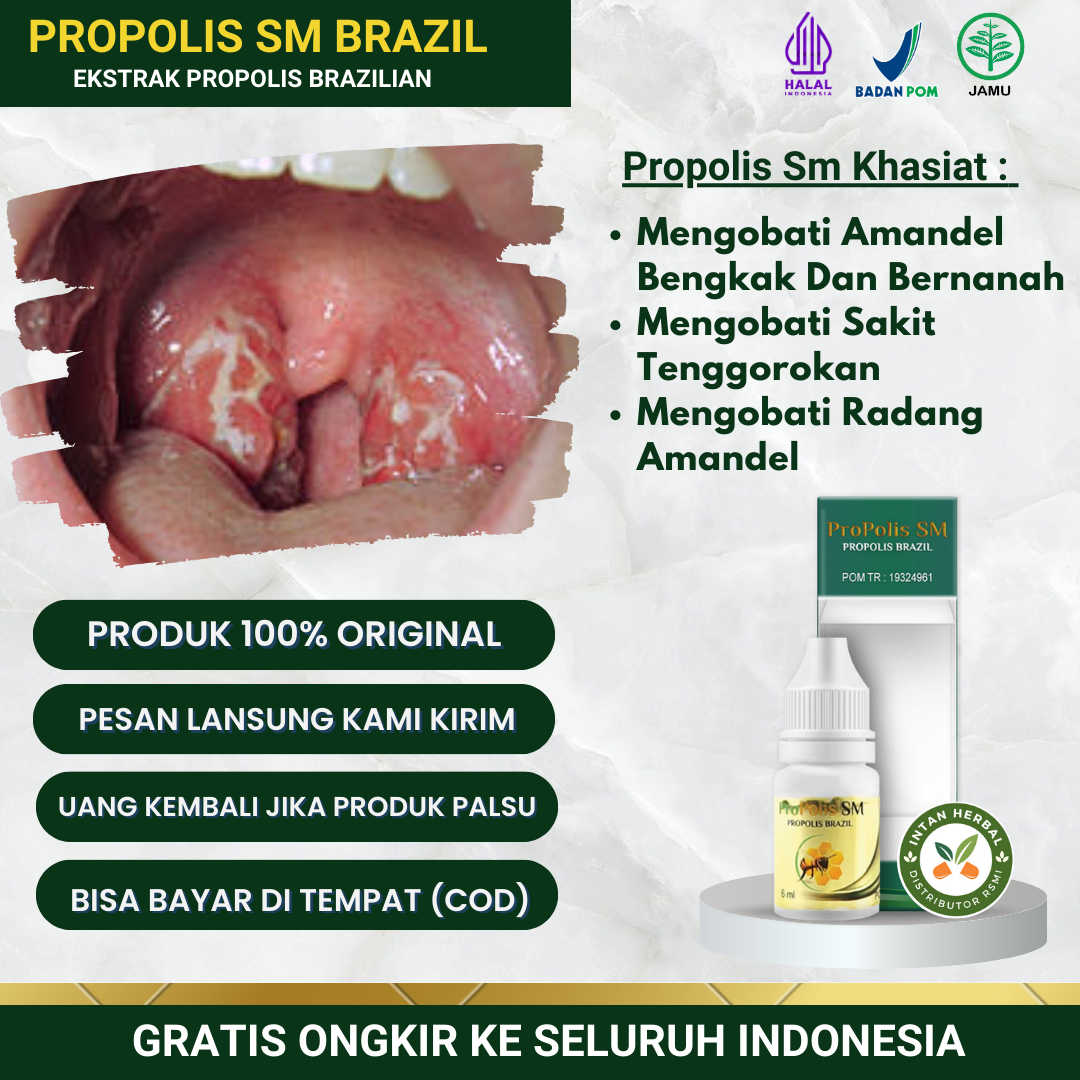 Obat Amandel, Radang Amandel, Sakit Tenggorokan, Amandel Kronis ...