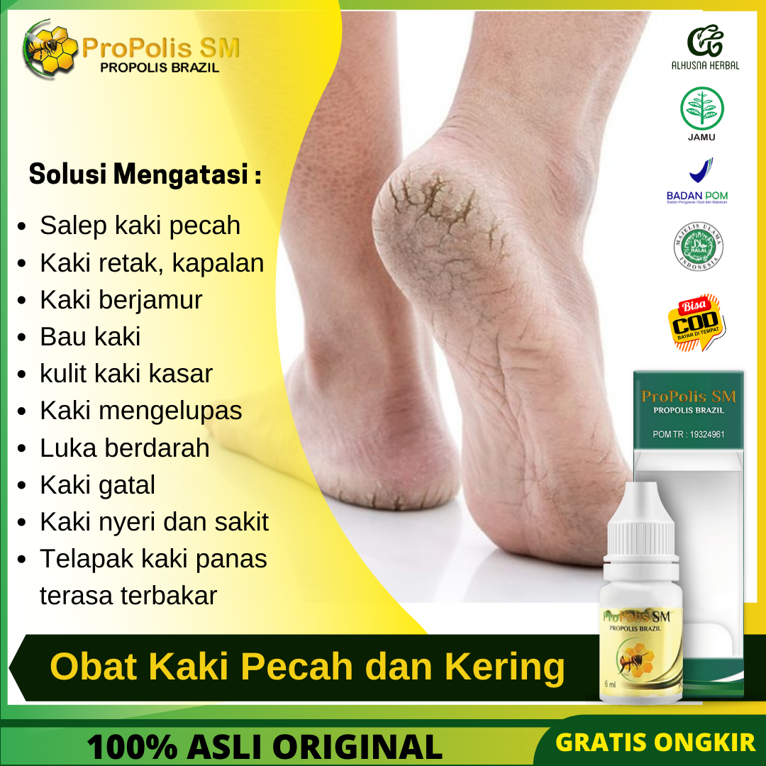 Obat Kaki Pecah dan Kering dgn PROPOLIS SM 100% ALAMI - Obat Salep kaki ...