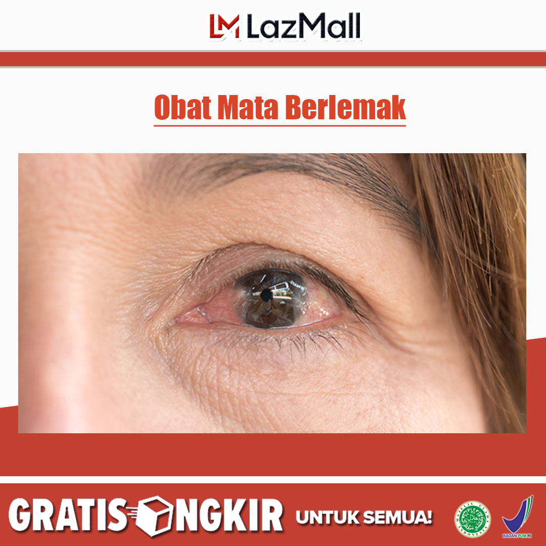 Obat Mata Berlemak / Ptegerium, Obat Mata Bintitan, Obat Mata Kalazion ...